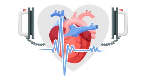 Differences Between Heart Attack, Cardiac Arrest, Stroke, and Brain ...